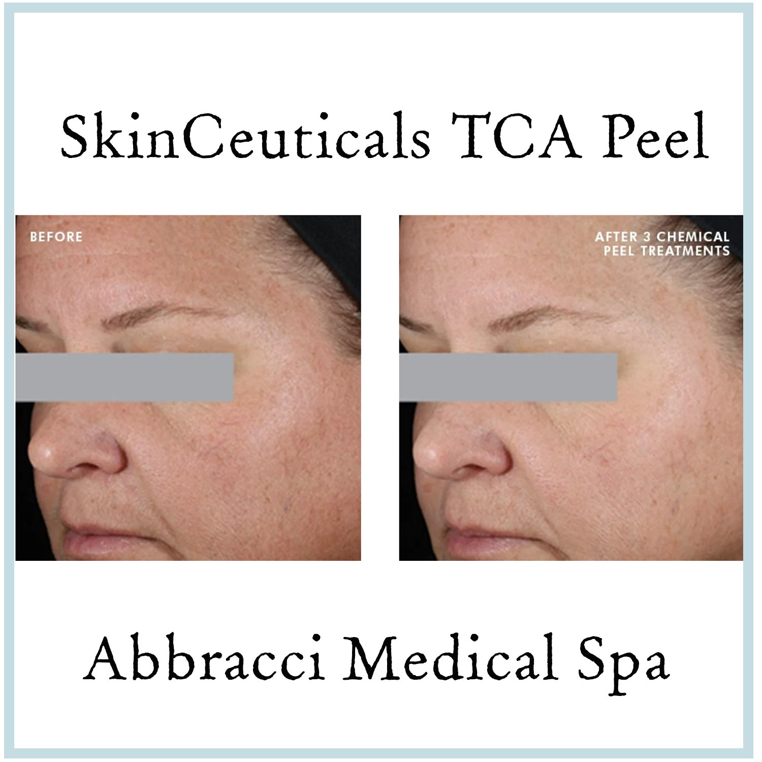 Our October Specials are Clear Skin Goals! - Abbracci Med Spa